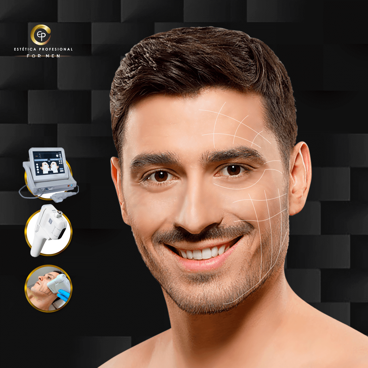 ULTRA LIFTING HIFU FULL FACE (4) | EP ESTÉTICA PROFESIONAL