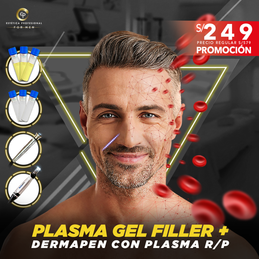 PLASMA GEL FILLER + DERMAPEN CON PLASMA RP – FM – pw | EP ESTÉTICA ...