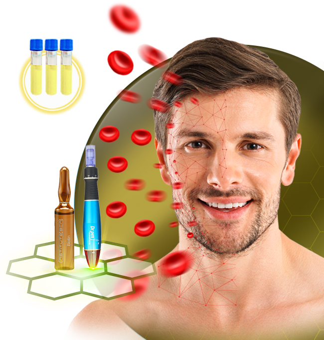 DERMAPEN CON PLASMA RP MAS ACIDO HIALURÓNICO NR | EP ESTÉTICA PROFESIONAL