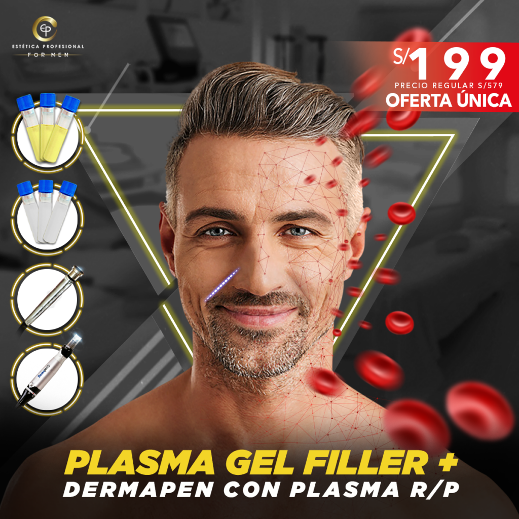 PLASMA GEL FILLER + DERMAPEN CON PLASMA RP – FM – pw | EP ESTÉTICA ...