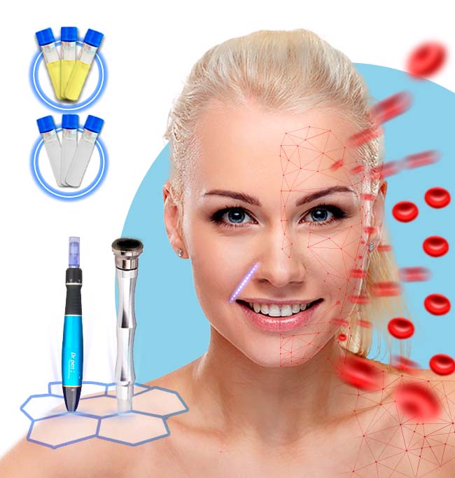 Plasma Gel Filler + Dermapen con Plasma R/P Facial | EP ESTÉTICA ...