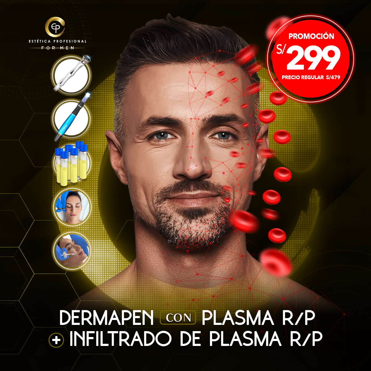 DERMAPEN CON PLASMA RP MAS INFILTRADO DE PLASMA NR FM | EP ESTÉTICA ...